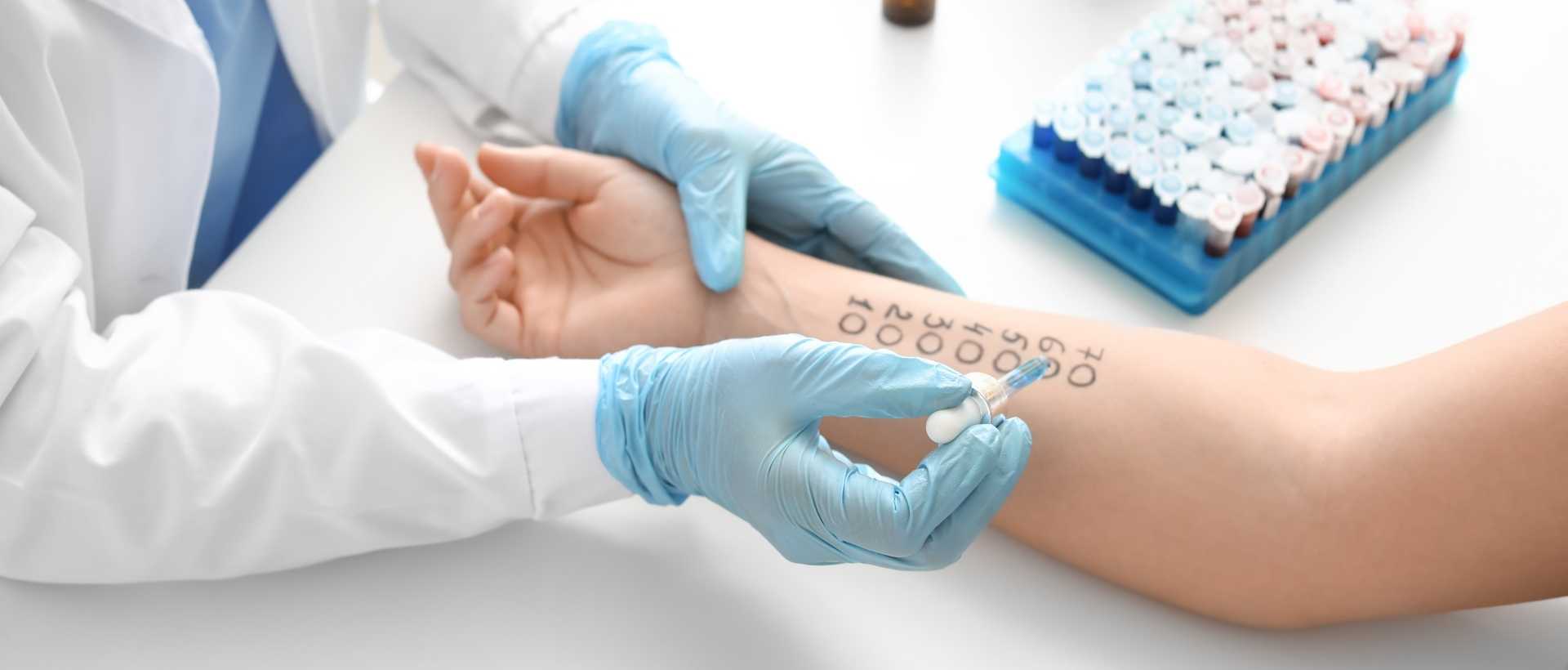 Prick test o test cutáneo - Alergomed