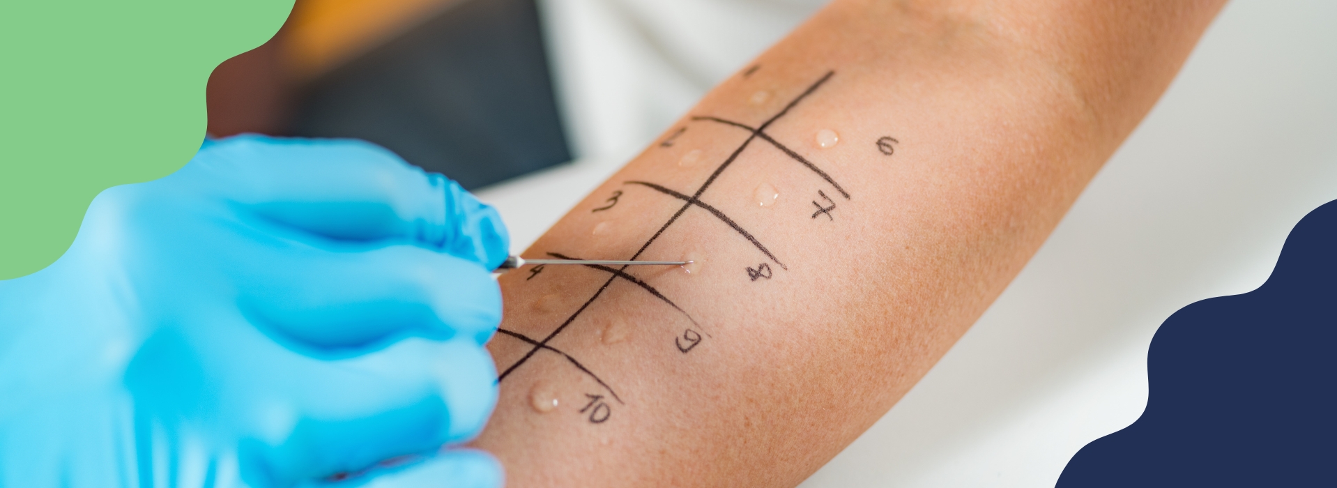 La Precisión del Test Cutáneo con Alimentos Frescos para Alergias